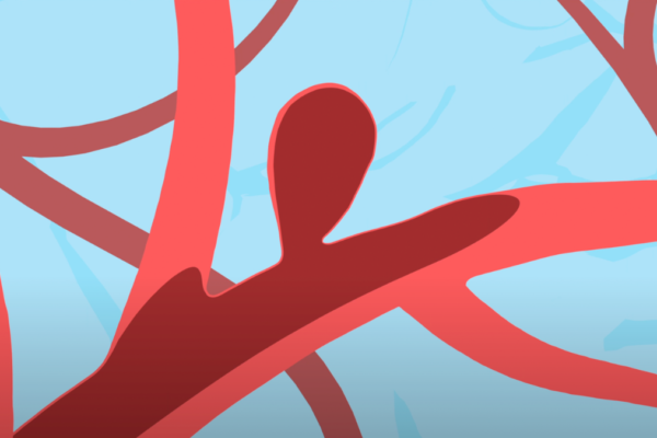 Aneurysm Clipping Surgery | Effective Brain Aneurysm Treatment