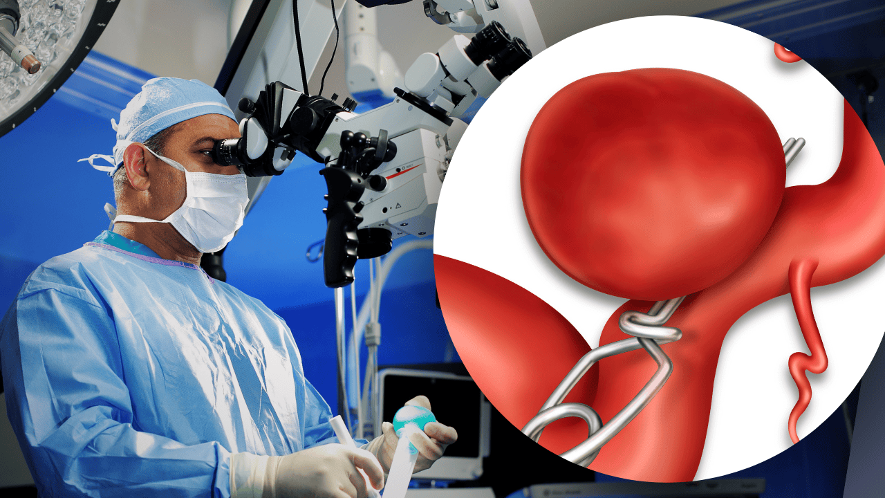 Aneurysm Clipping Surgery Effective Brain Aneurysm Treatment Aneurysm Clipping Surgery Effective Brain Aneurysm Treatment